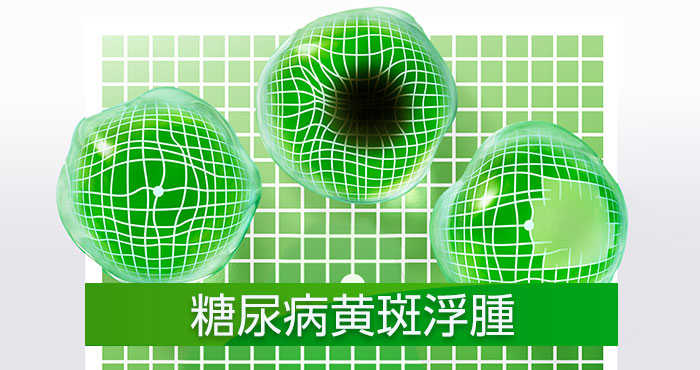 Vision 100 網膜ドットコム ノバルティス ヘルスケア ノバルティス ファーマ株式会社